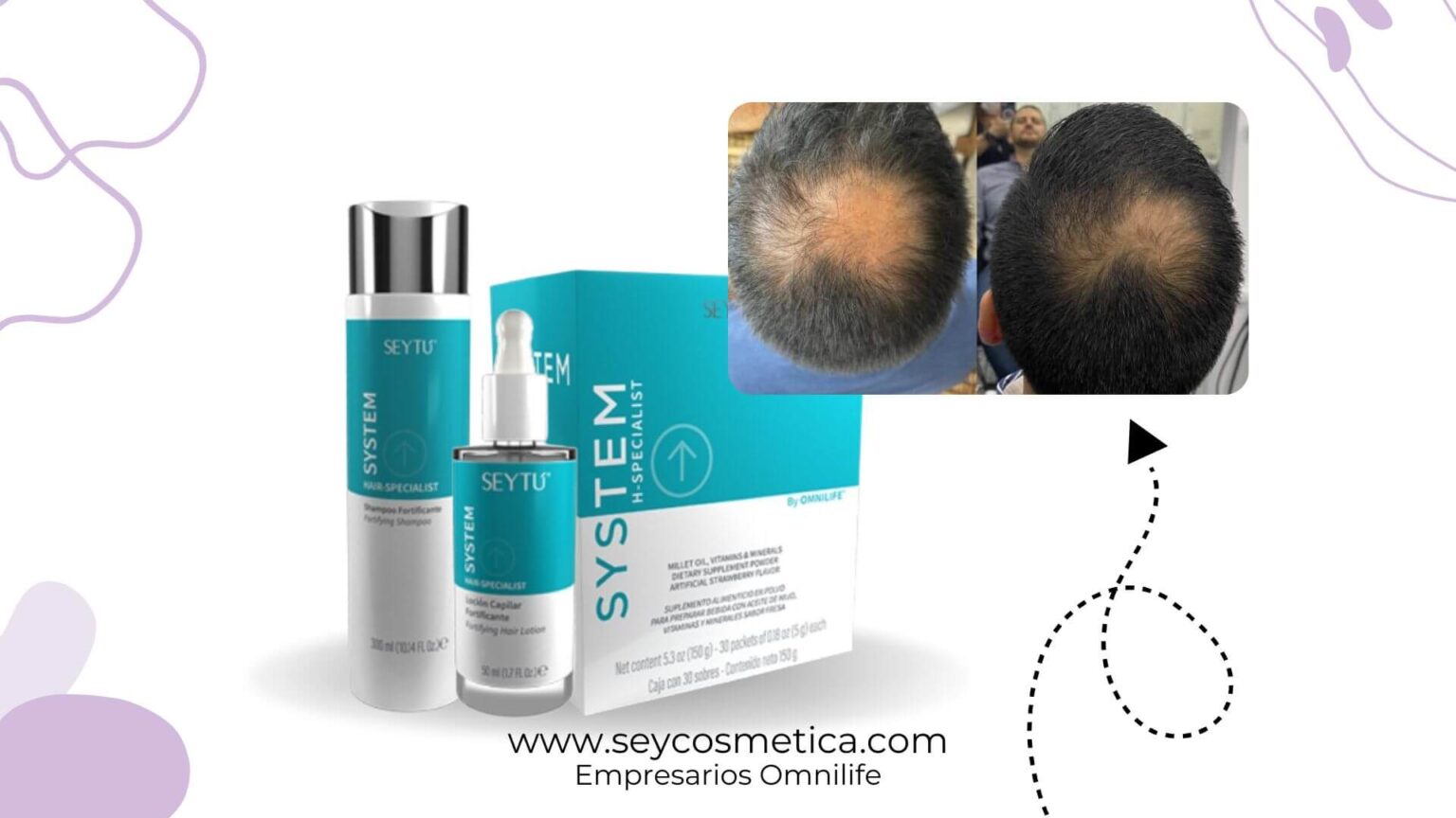 Productos para la caída del cabello Sistema Hair-Specialist SEYTU